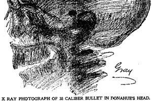 5 Things You Should Know About Radiation, Because They Are Interesting ...